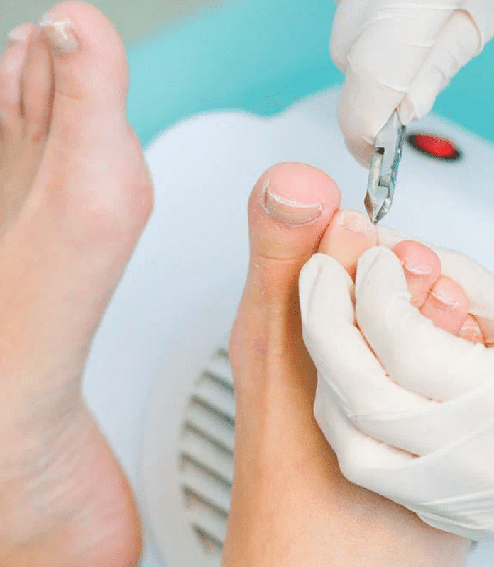 Toe Nail Surgery & Removal in Bedford | One Podiatry